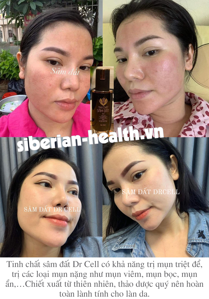 [Hàng chính hãng] Tinh chất sâm đất Dr Cell